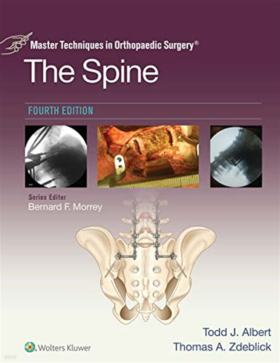 Master Techniques in Orthopaedic Surgery: The Spine - 예스24