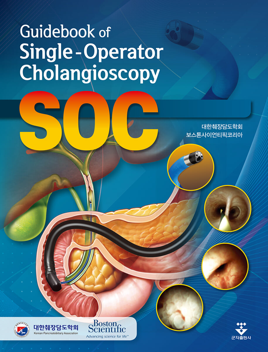 Guidebook of Single-Operator Cholangioscopy - YES24