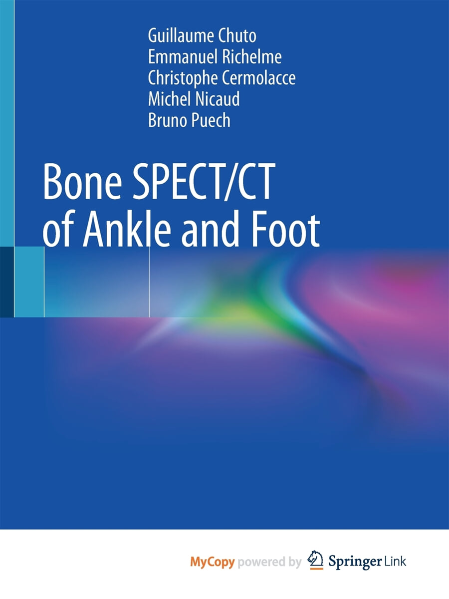 Bone SPECT/CT of Ankle and Foot - 예스24
