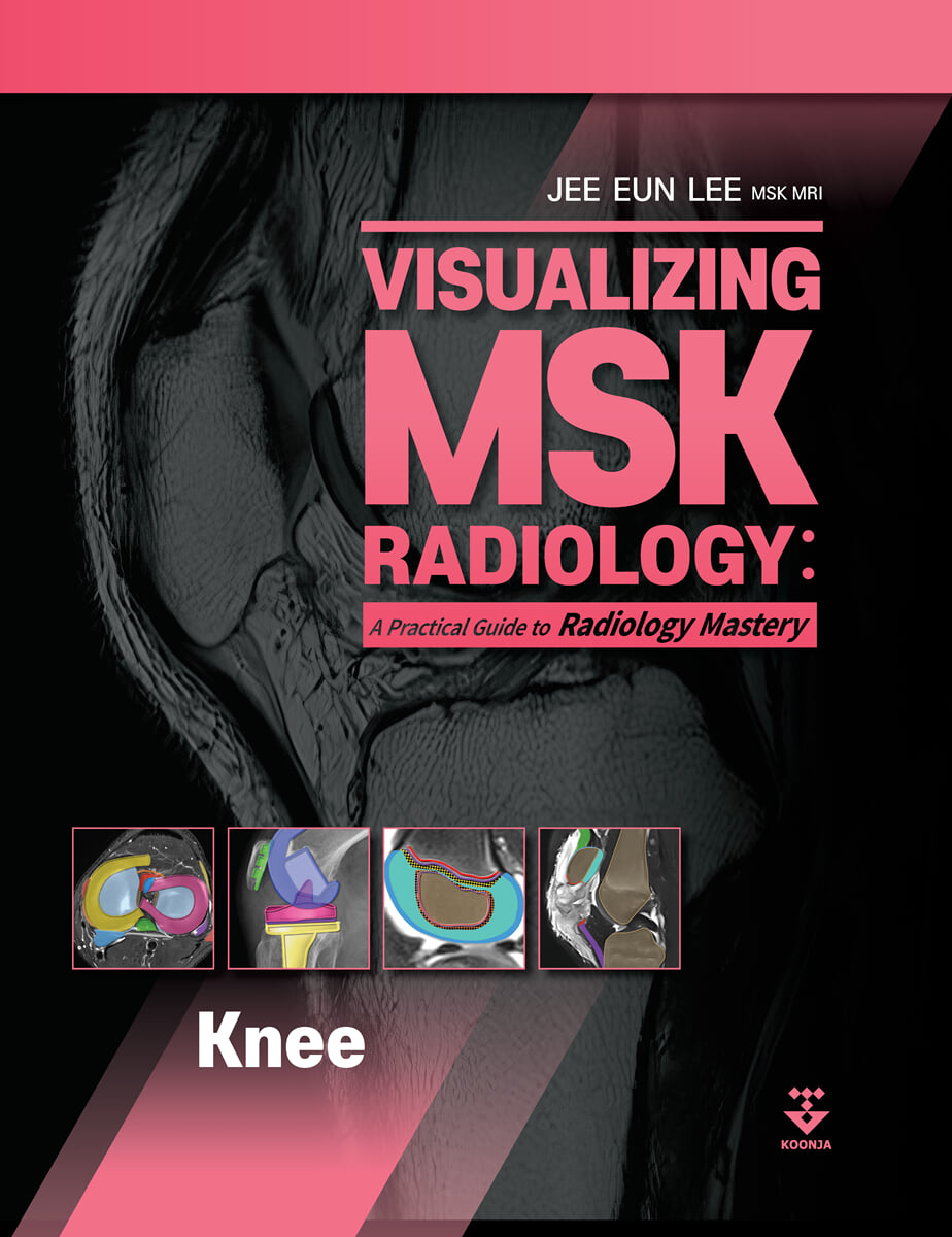 Visualizing MSK Radiology : A Practical Guide to Radiology Mastery ...