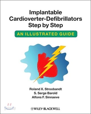 Implantable Cardioverter - Defibrillators Step by Step: An Illustrated ...