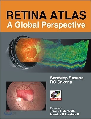 Retina Atlas - 예스24
