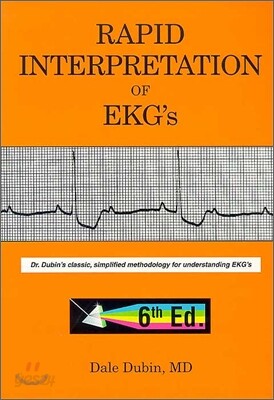 Rapid Interpretation of EKG's: Dr. Dubin's Classic, Simplified ...