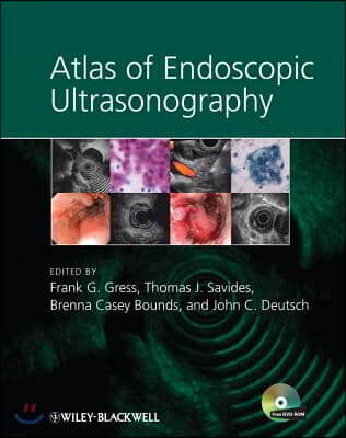 Atlas of Endoscopic Ultrasonography - 예스24