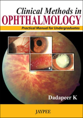 Clinical Methods in Ophthalmology: Practical Manual for Undergraduates ...
