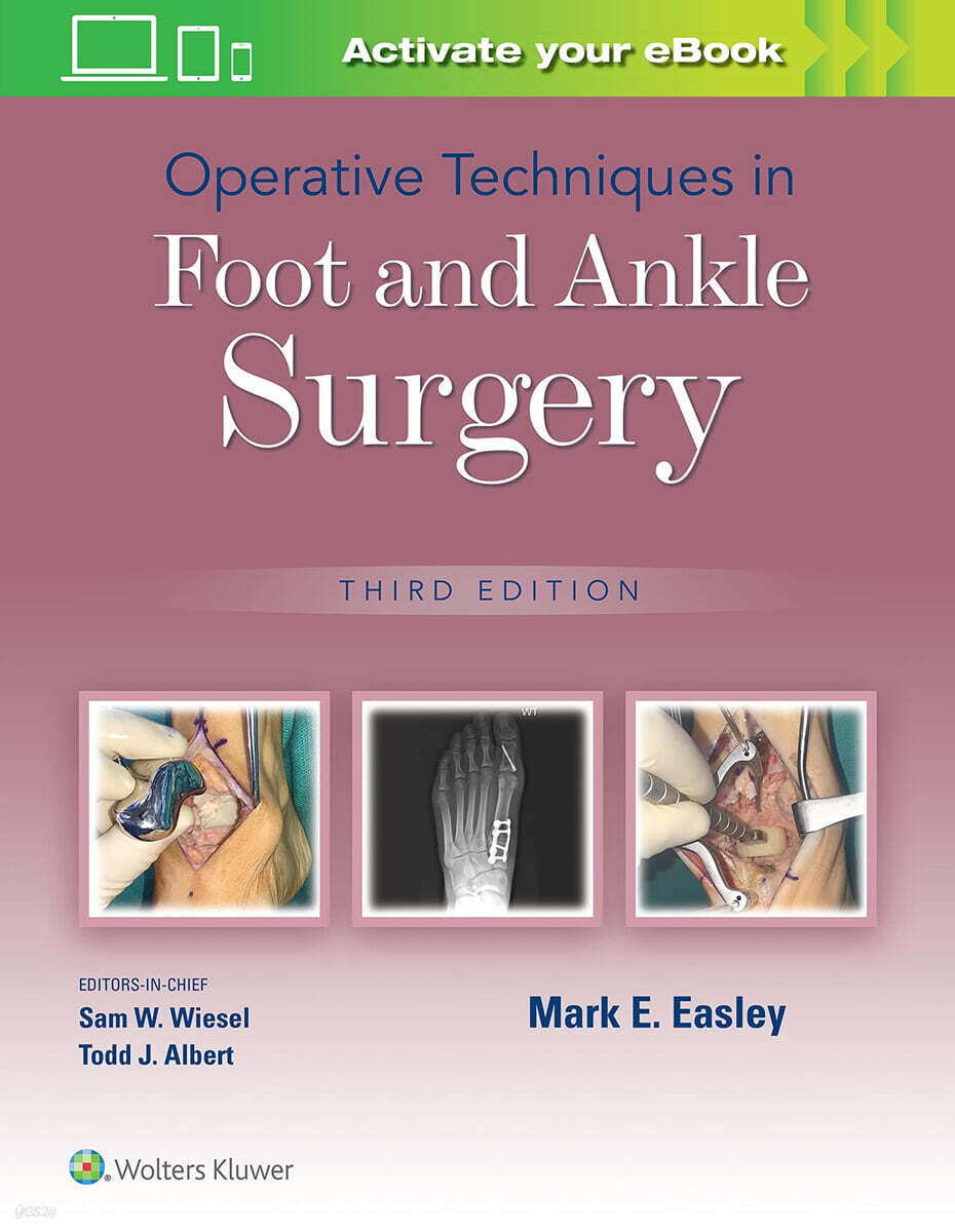 Operative Techniques in Foot and Ankle Surgery - 예스24