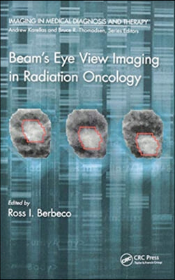 Beam's Eye View Imaging in Radiation Oncology - 예스24
