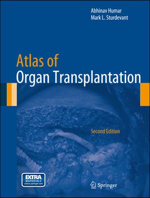Atlas of Organ Transplantation - 예스24