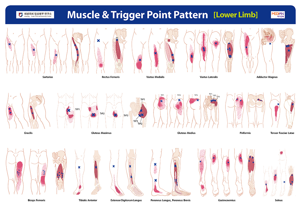 Muscle & Trigger Point Pattern Chart & Book (도서+차트2장) : 메디칼플러스