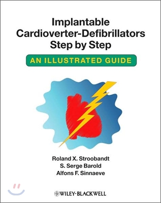 Implantable Cardioverter - Defibrillators Step by Step: An Illustrated ...